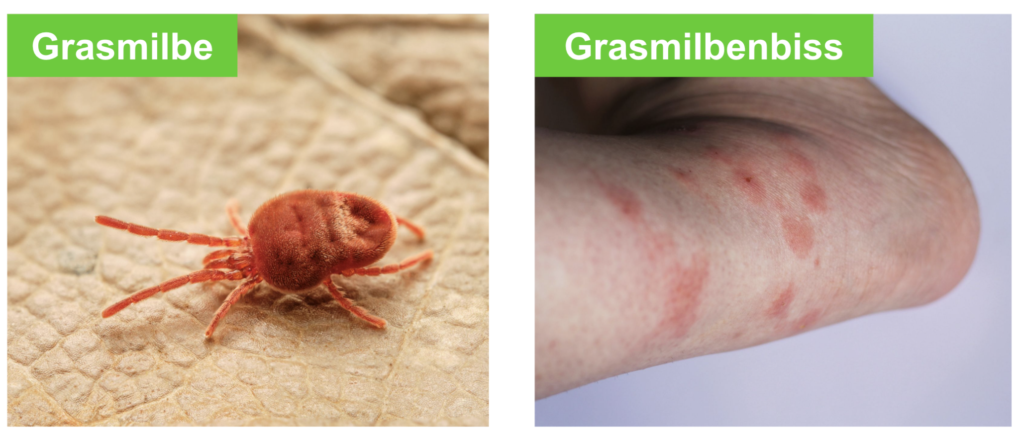 Milbenbisse erkennen und behandeln: Symptome und Mittel - ERASIO